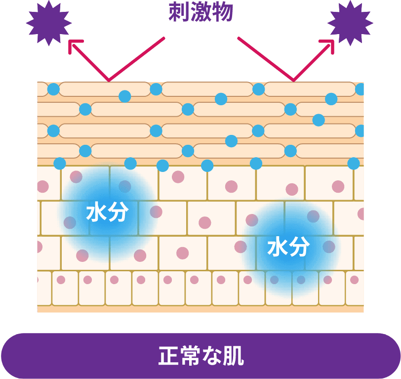 どうしてかゆみが止まらないの？アトピー性皮膚炎の3つの原因 │アトピーについて知る│アトピーみらい アトピー性皮膚炎患者さんとご家族向けの